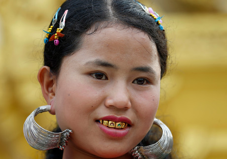 Taang Palaung Ethnic Woman Gold Teeth Editorial Stock Photo - Stock ...