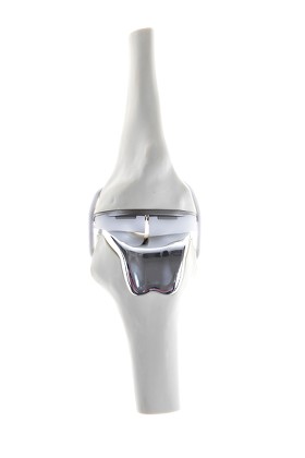 Knee Prosthesis Knee Endoprosthesis Knee Joint Editorial Stock Photo ...