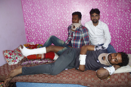 Injured Men After Assault By Locals Editorial Stock Photo - Stock Image ...