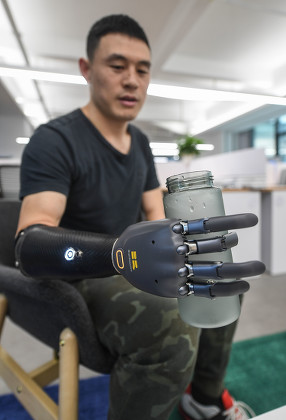Amputated Man Uses Brainrobotics Smart Prosthetic Editorial Stock Photo ...