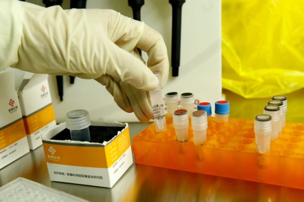 Medical Worker Prepares Test Reagents Polymerase Editorial Stock Photo ...