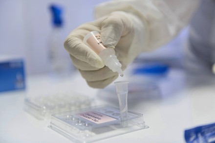 Medical Student Performs Covid19 Rapid Test Editorial Stock Photo ...