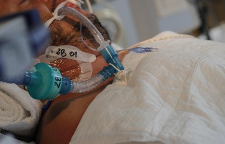 Intubated Patient Lays Bed Intensive Care Editorial Stock Photo - Stock ...