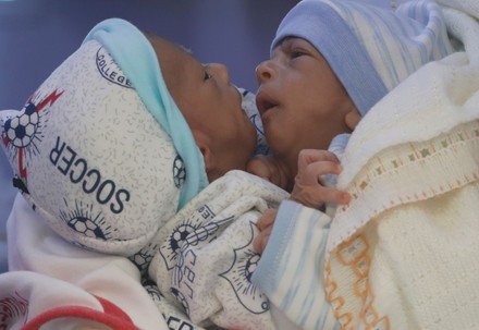 Conjoined Twin Male Babies Muhammed R Editorial Stock Photo - Stock ...