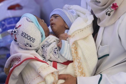 Nurse Holds Yemeni Conjoined Twins Mohammed Editorial Stock Photo ...