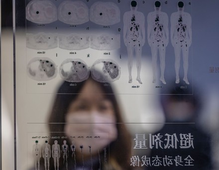 Visitor Looks Magnetic Resonance Imaging Mri Redaktionelles Stockfoto ...