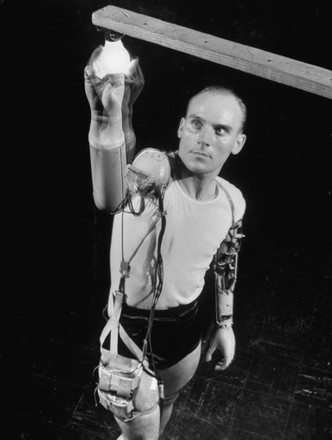 June 1950 Amputee Wearing Power Driven Editorial Stock Photo - Stock ...