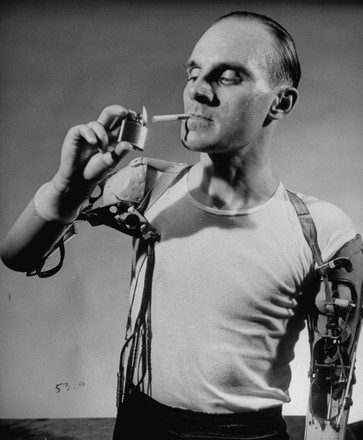 June 1950 Amputee Wearing Power Driven Editorial Stock Photo - Stock ...