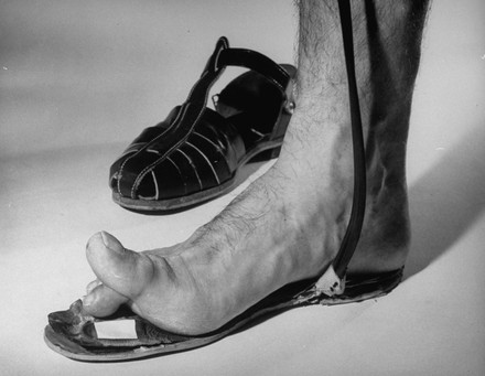 June 1950 Amputee Wearing Power Driven Editorial Stock Photo - Stock ...