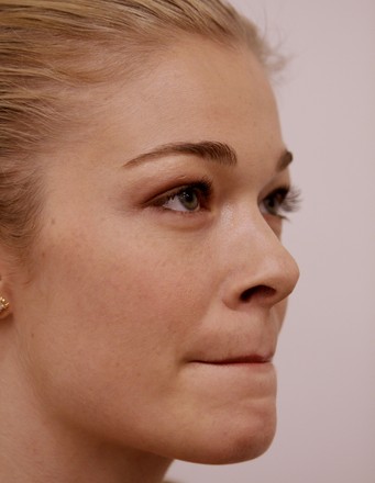 Sen. Menendez, singer LeAnn Rimes launch Psoriasis legislation in ...
