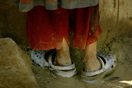 Girl Stands Mud She Pumps Water Editorial Stock Photo - Stock Image ...