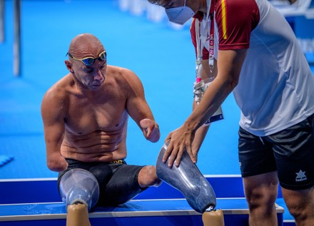 Xavier Torres Esp Fits His Prosthetic Editorial Stock Photo - Stock ...