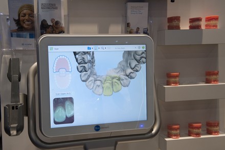 Real Time Scan Teeth 3d Printing Editorial Stock Photo - Stock Image ...