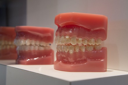 Prototypes 3d Printed Teeth By 3d Editorial Stock Photo - Stock Image ...