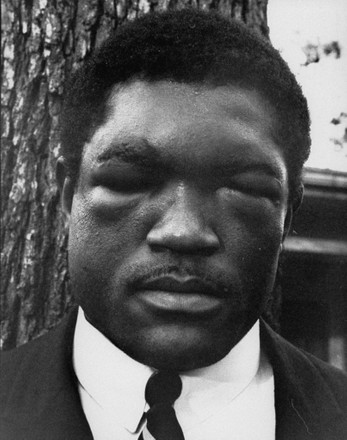 Swollen Face Pro Boxer Ernie Terrel Editorial Stock Photo - Stock Image ...