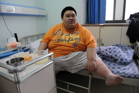 Liang Yong Whose Weight Has Dropped Editorial Stock Photo - Stock Image ...