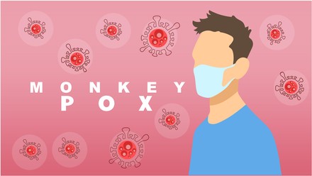 Monkeypox Virus Illustration Vector Hands Monkeypox Editorial Stock ...