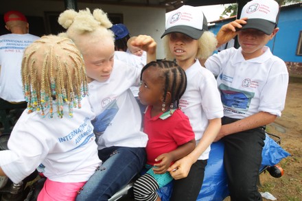 Liberian Albinos Parade Through Streets Mark Editorial Stock Photo ...