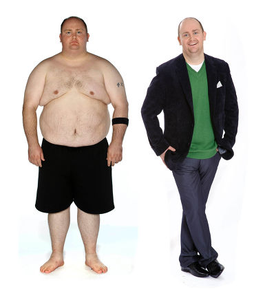 Wil Graham Before After Losing 8 Editorial Stock Photo - Stock Image ...