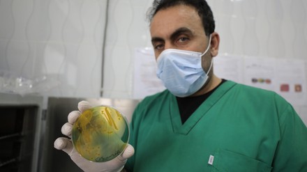 Researcher Works Epidemiological Analysis Lab Ngo Editorial Stock Photo ...