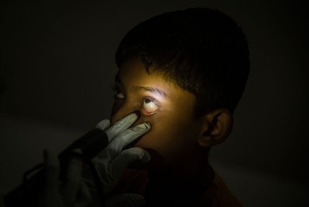 Indian Doctor Uses Torch Examine Eye Editorial Stock Photo - Stock ...