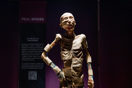 Human Body Posing Real Bodies Exhibition Editorial Stock Photo - Stock ...