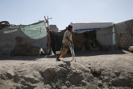 Displaced Yemeni Uses Crutches Help Him Editorial Stock Photo - Stock ...