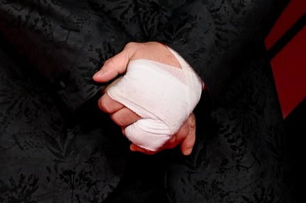 Ricky Hatton Hand Editorial Stock Photo - Stock Image | Shutterstock
