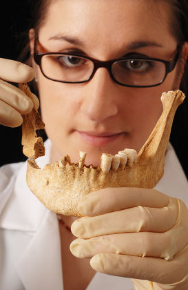 Osteologist Helen Webb Jaw Bone Recovered Editorial Stock Photo - Stock ...