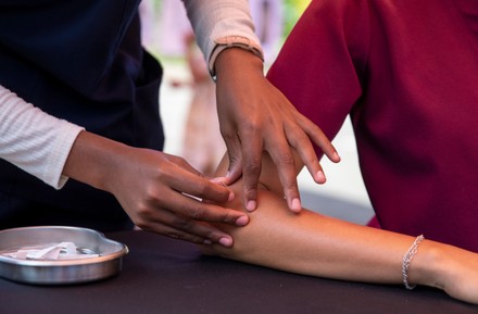 Student Receives Traditional Chinese Acupuncture Therapy Editorial ...
