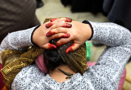 Leeches Suck Blood Womans Neck During Editorial Stock Photo - Stock ...