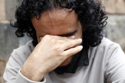 Man Reacts After Getting Traditional Cosmetic Editorial Stock Photo ...