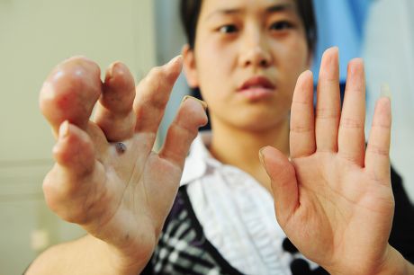 Yang Liping Editorial Stock Photo - Stock Image | Shutterstock