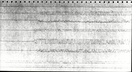 66 Seismograph Stock Pictures, Editorial Images and Stock Photos ...