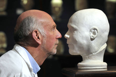 Gordon Findlater Head Anatomy Department William Editorial Stock Photo ...