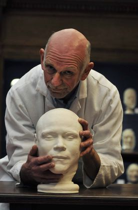 Gordon Findlater Head Anatomy Department Holds Editorial Stock Photo ...
