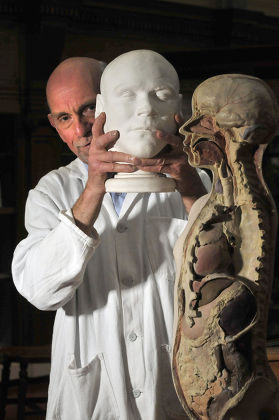 Gordon Findlater Head Anatomy Department Holds Editorial Stock Photo ...