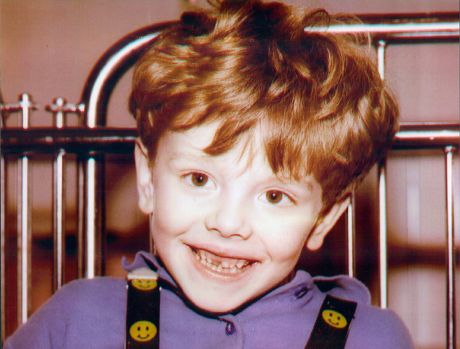 Five Year Old Adis Avdic Shrapnel Editorial Stock Photo - Stock Image ...