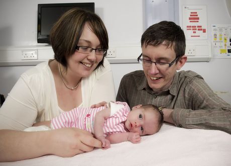 IVF 'Embryoscope' fertility microscope records moment of conception ...