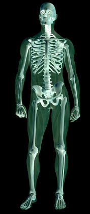 98 X rayed Stock Pictures, Editorial Images and Stock Photos | Shutterstock