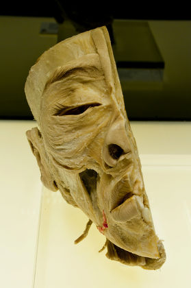 Plastination Specimen Sagittal Section Head Showing Editorial Stock ...