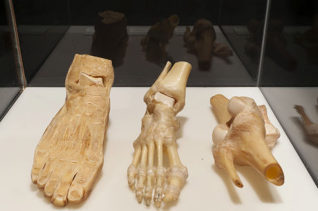 250 Skin and bones Stock Pictures, Editorial Images and Stock Photos ...