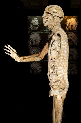 Plastination Specimen Half Human Body Without Editorial Stock Photo ...