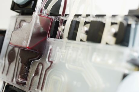 Trima Accel Automated Blood Collection System Editorial Stock Photo ...