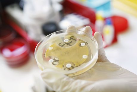 30 Bacterial growth Stock Pictures, Editorial Images and Stock Photos ...