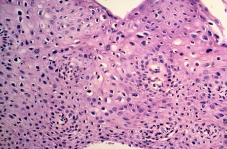 73 Cervix Stock Pictures, Editorial Images and Stock Photos | Shutterstock