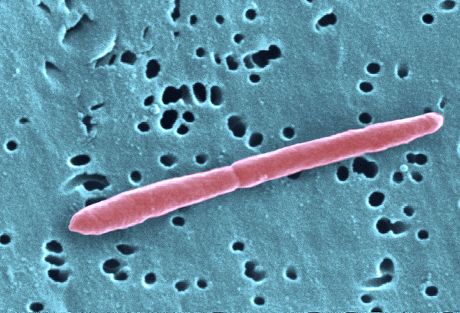 8 Fusobacteriales Stock Pictures, Editorial Images and Stock Photos ...