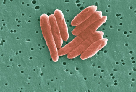 8 Fusobacteriaceae Stock Pictures, Editorial Images and Stock Photos ...