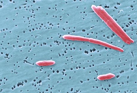 8 Fusobacteriales Stock Pictures, Editorial Images and Stock Photos ...