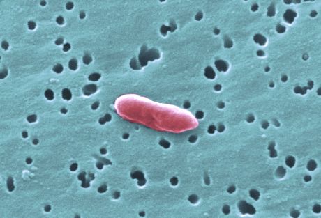 8 Fusobacteria Stock Pictures, Editorial Images and Stock Photos ...